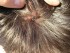 Minor Scalp Wounds – LifeSaver Training